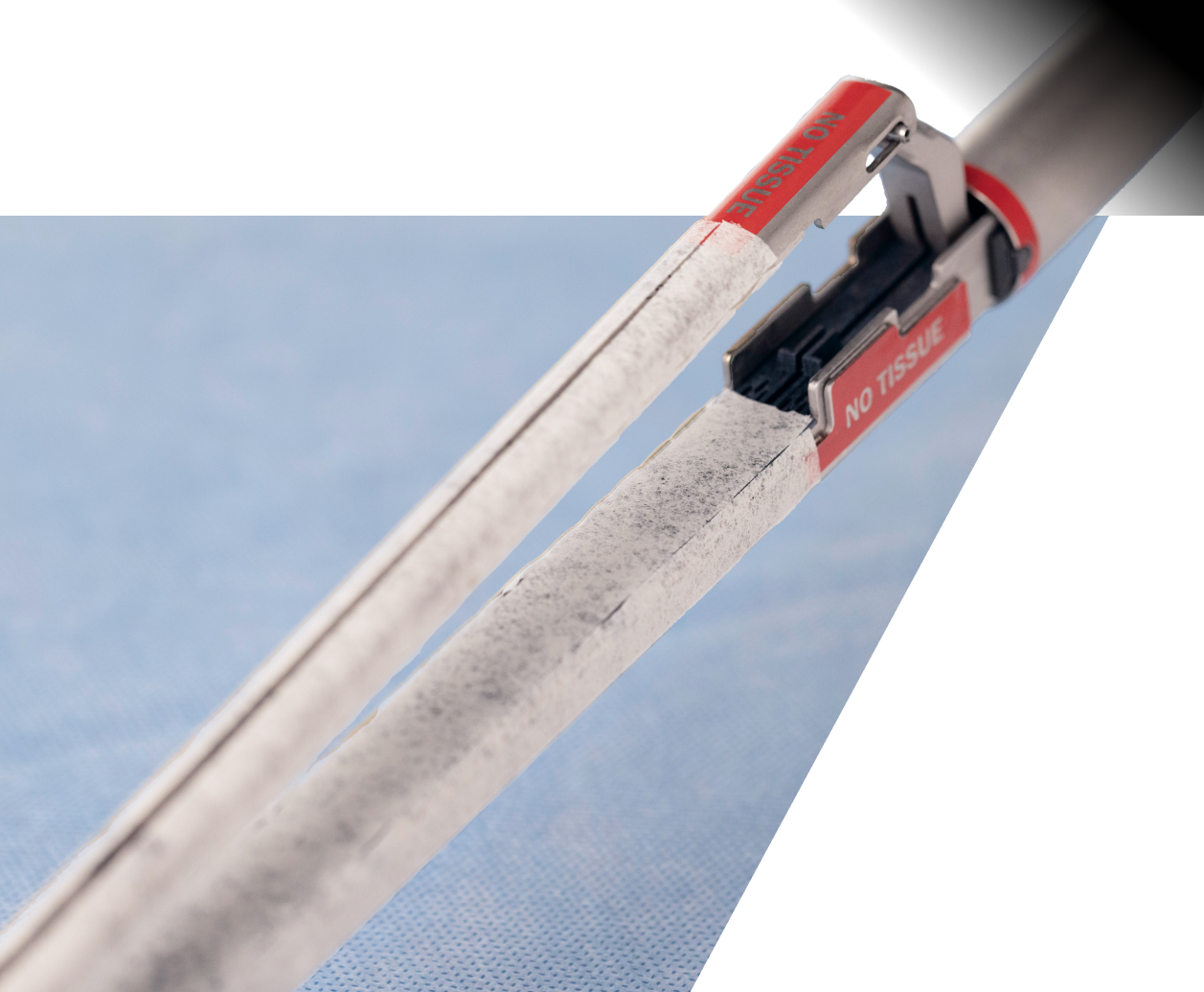 STAPLE-LINE REINFORCEMENT | Standard Bariatrics